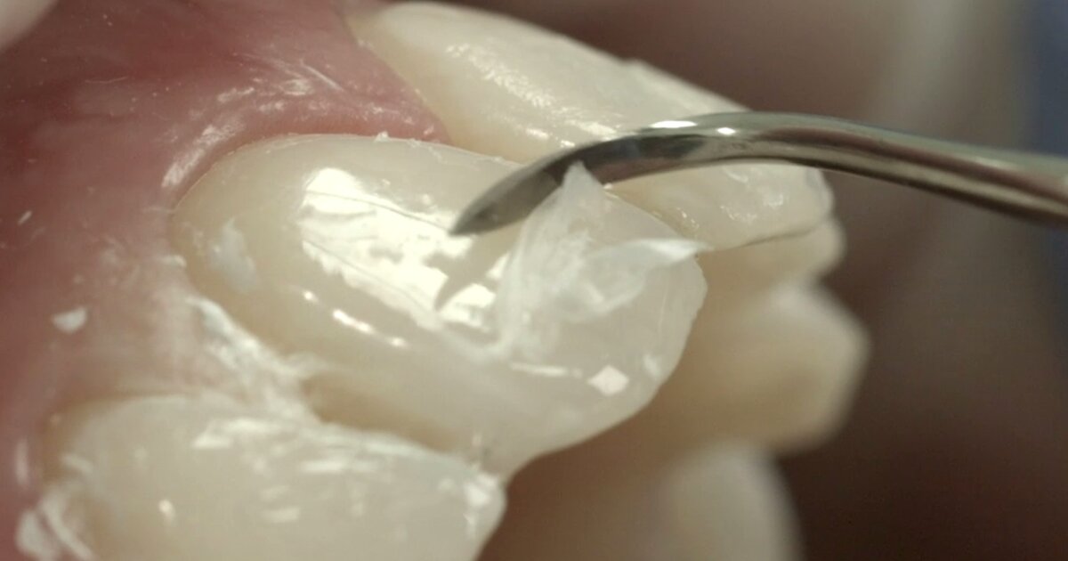 Modern Dental Materials and Solutions | Ivoclar UK & Ireland