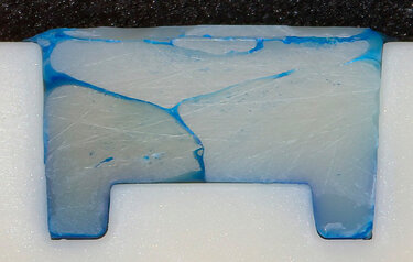 Premium restorations with bulk-fill composites | Ivoclar