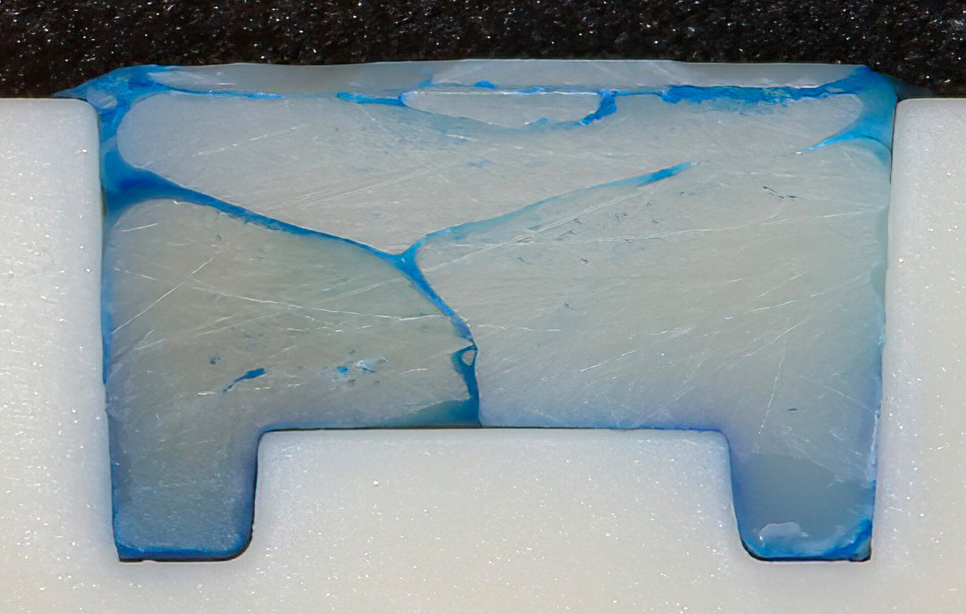 Premium restorations with bulk-fill composites | Ivoclar