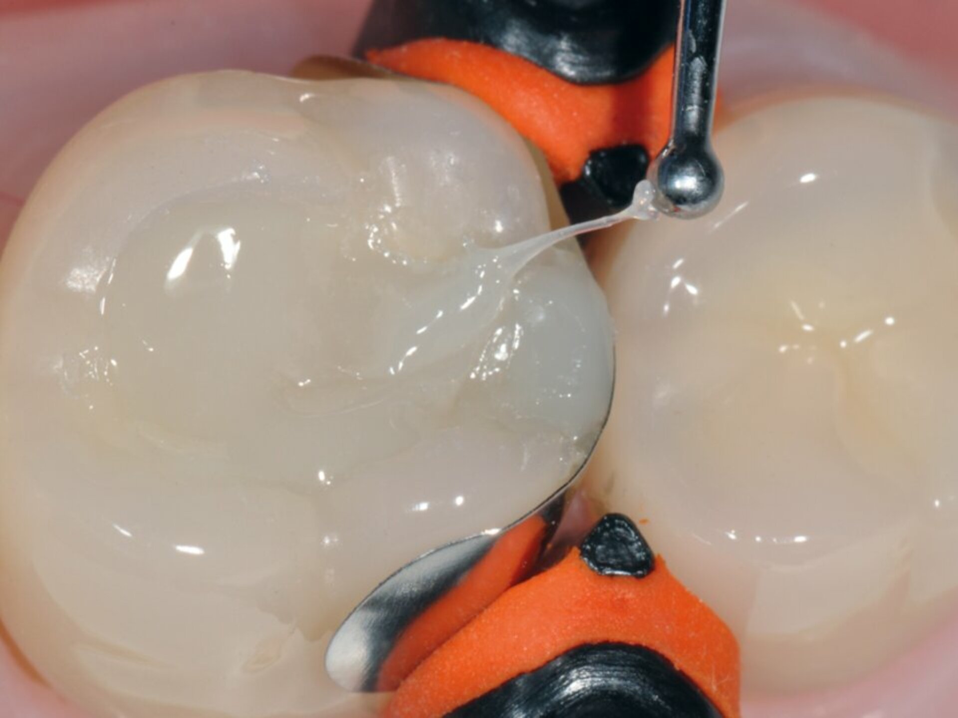 Expand your knowledge with the Direct Restorative Knowledge Hub