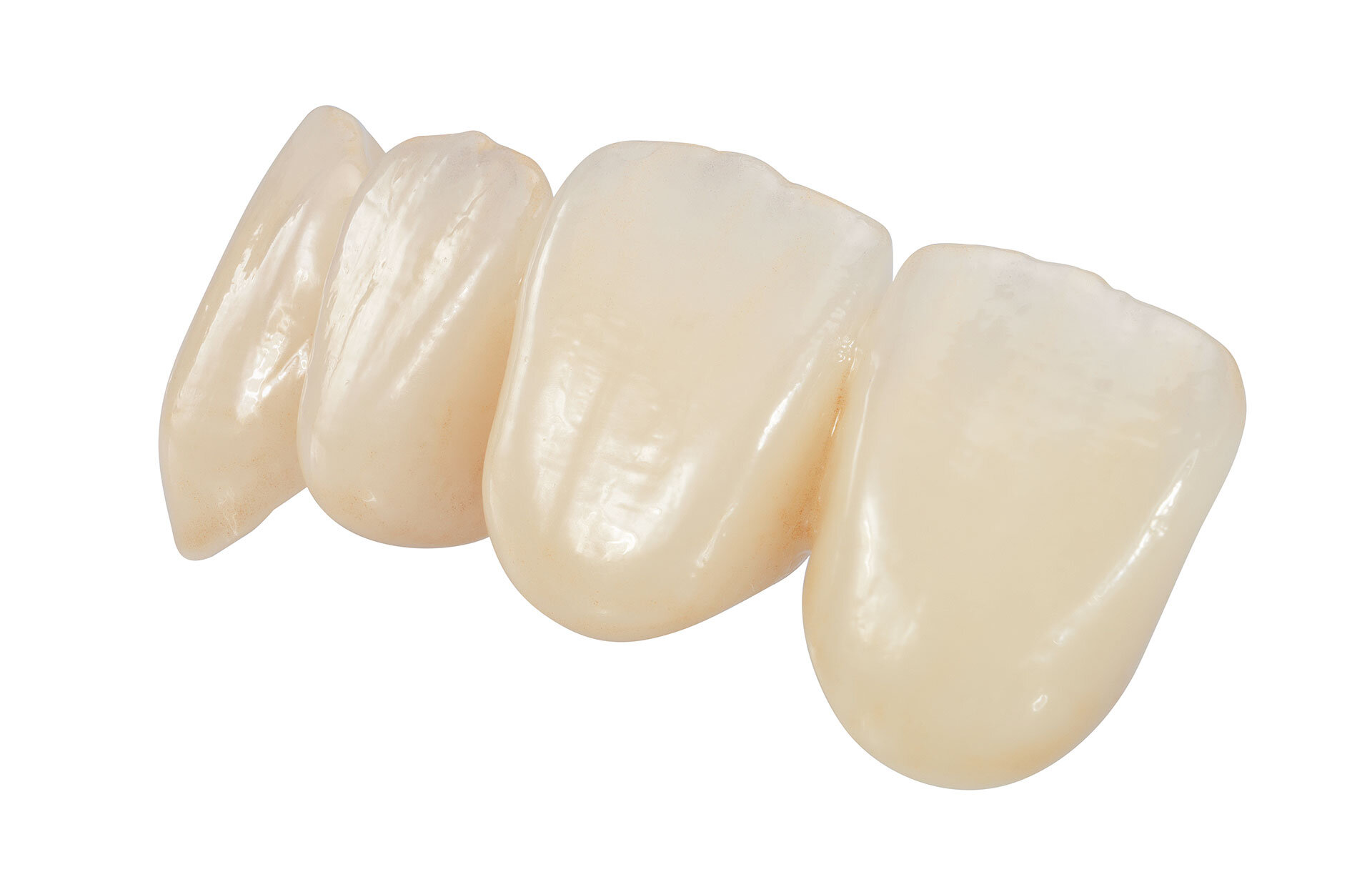 20 Years of IPS e.max: Leading All Ceramic Dental Material | Ivoclar