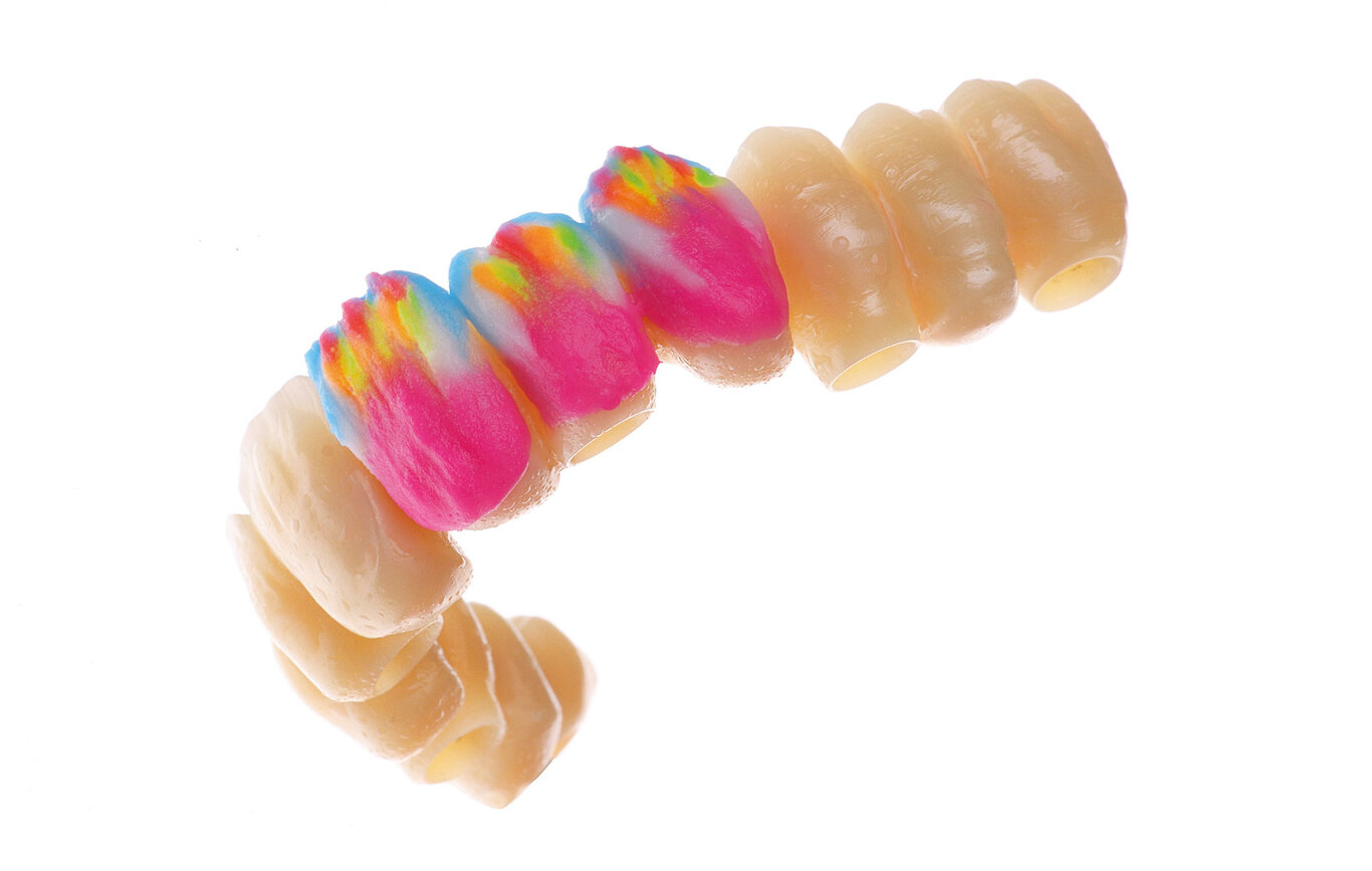 20 Years of IPS e.max: Leading All Ceramic Dental Material | Ivoclar