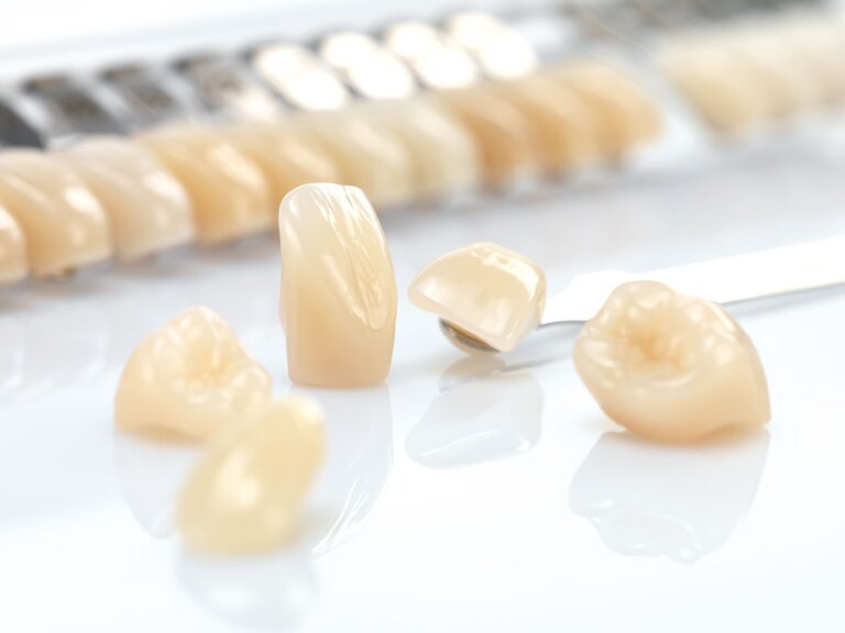 Fascination Prosthetics | Ivoclar