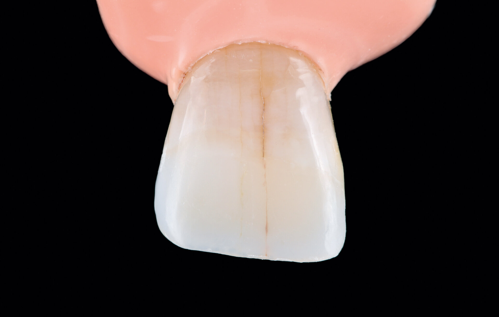 IPS Empress Direct Effect, Opaque and Color | Dental Composites | Ivoclar