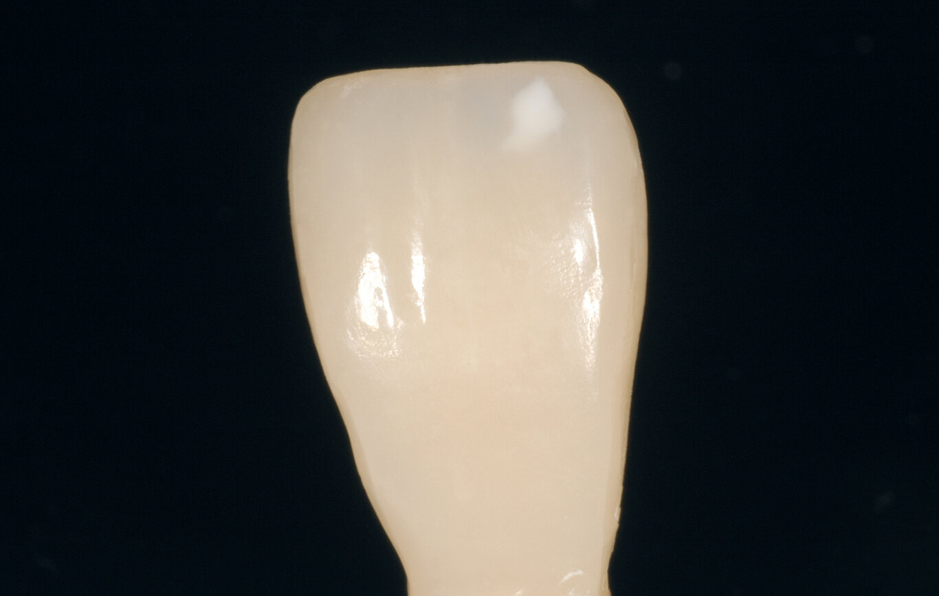 IPS Empress Direct | Dental Composites | Ivoclar USA