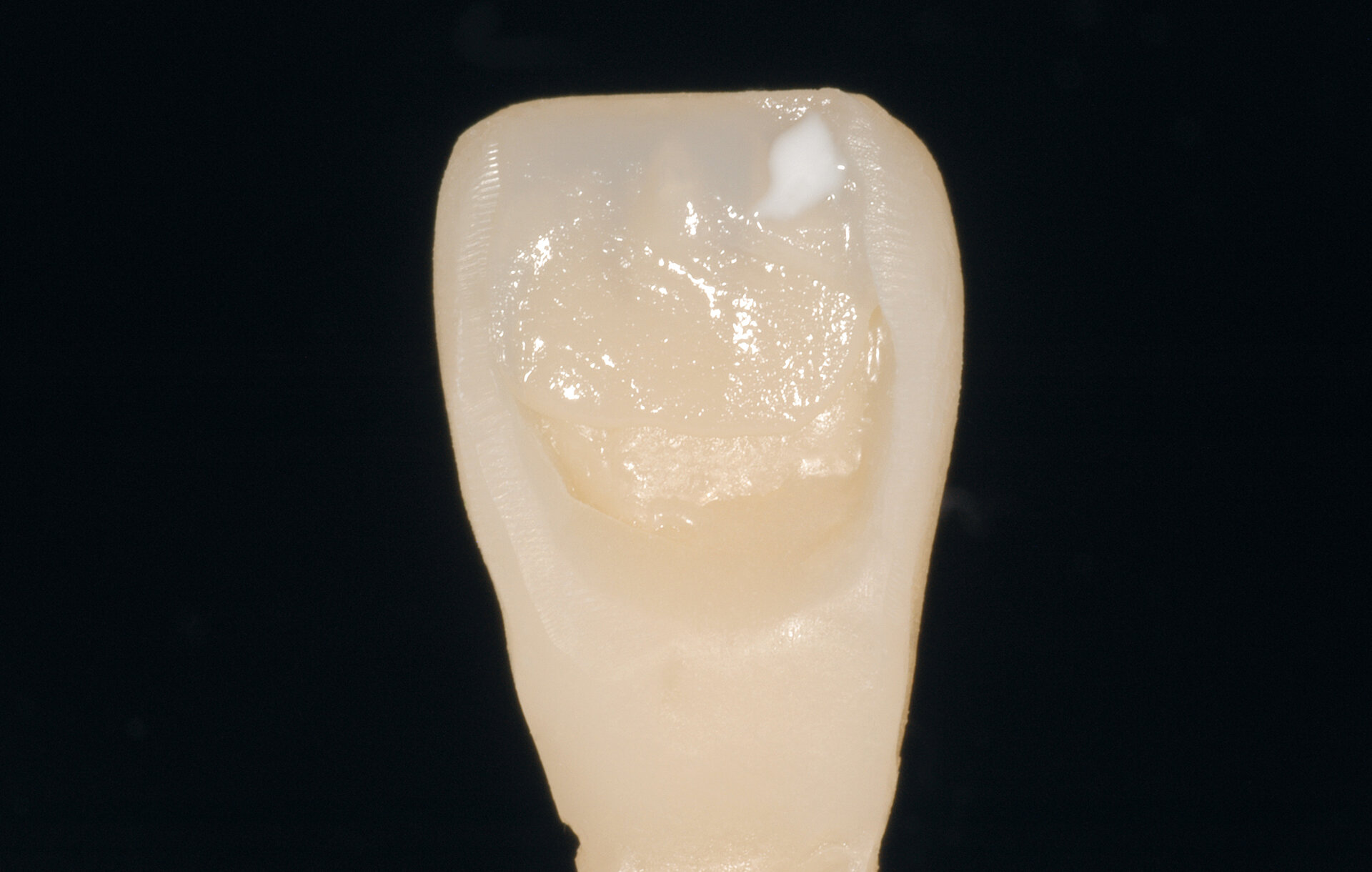 IPS Empress Direct | Dental Composites | Ivoclar