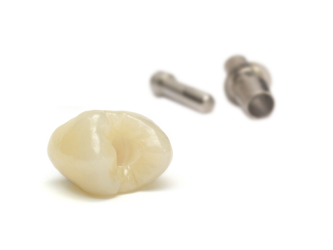 IPS e.max Press | Glass-ceramic Dental Restorations | Ivoclar USA