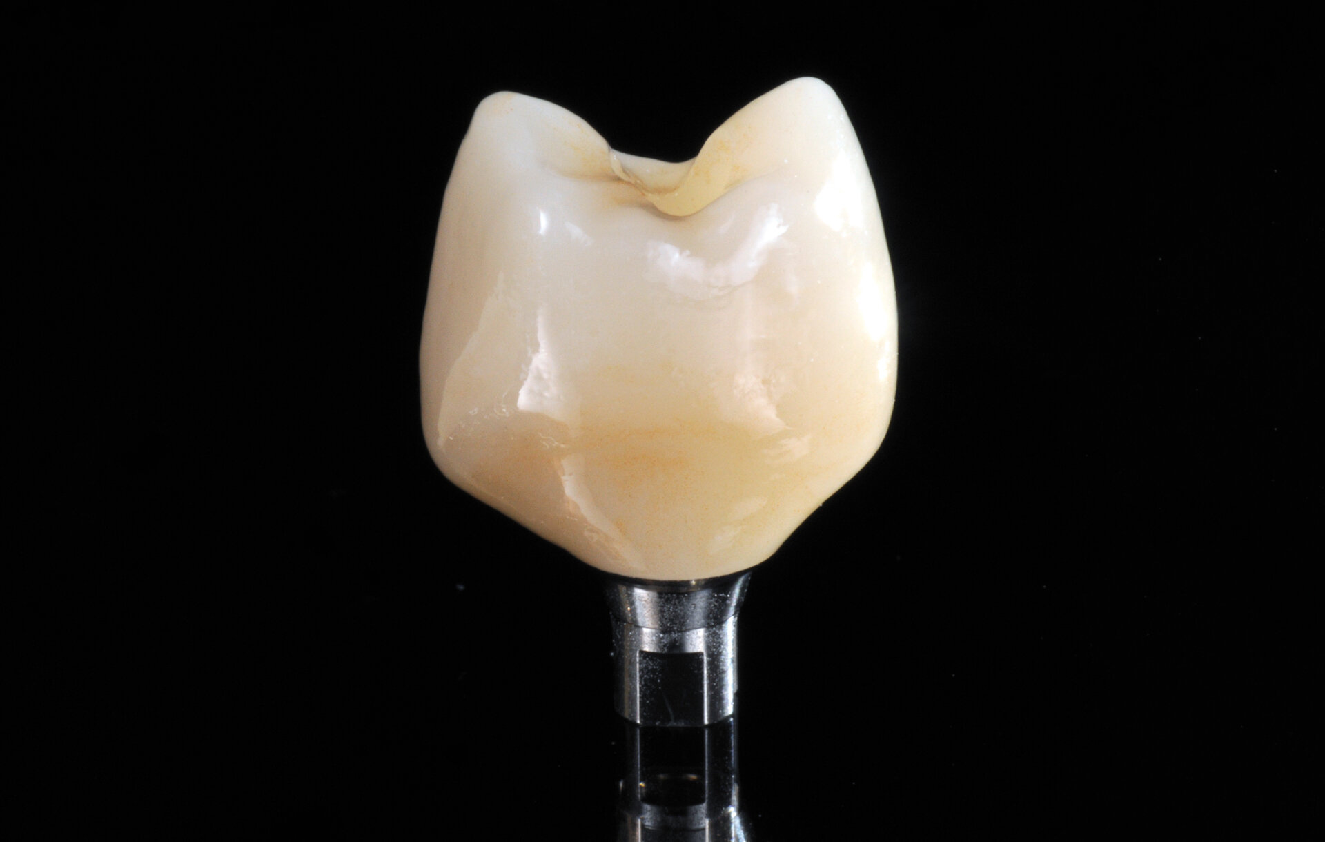 IPS e.max Press | Glass-ceramic Dental Restorations | Ivoclar USA