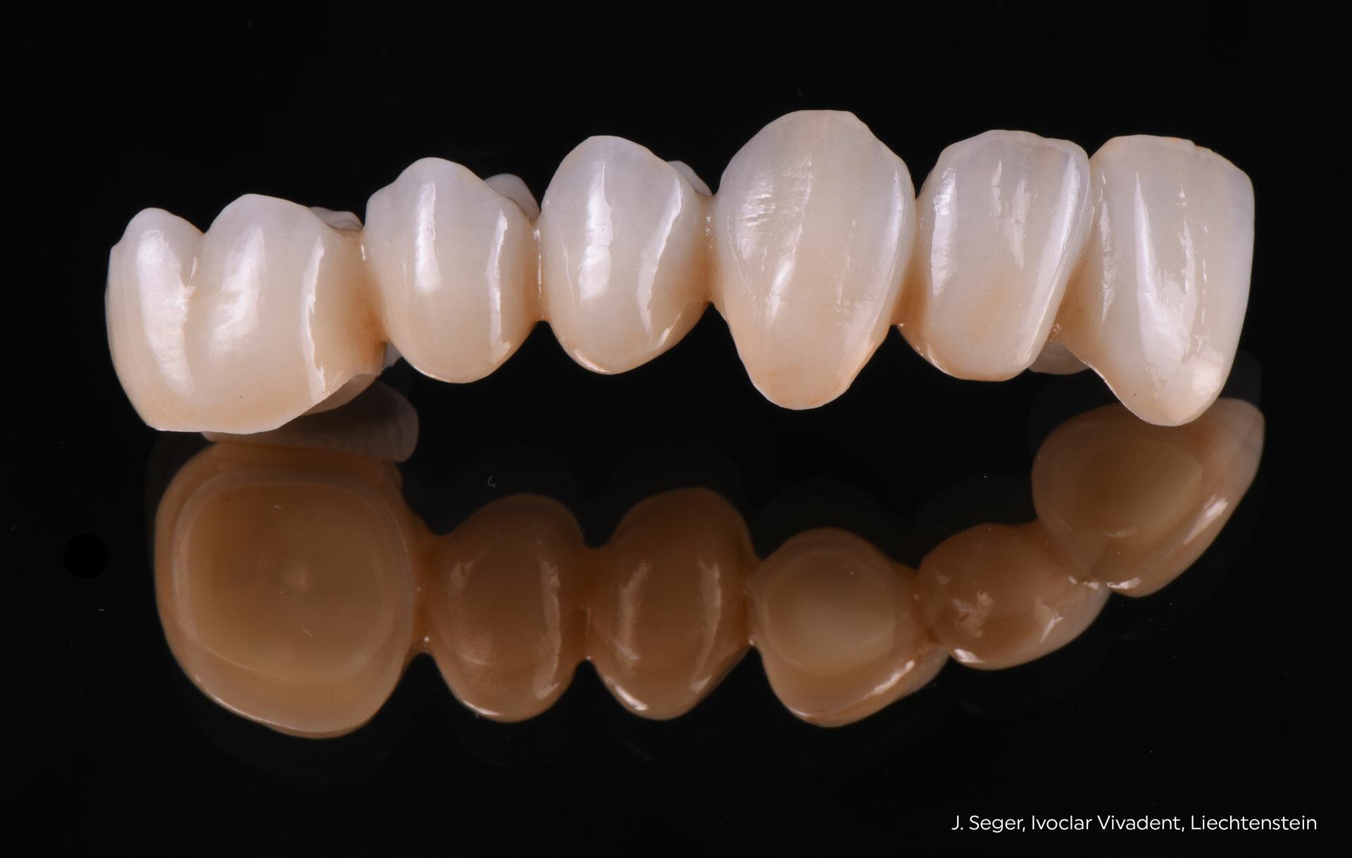IPS e.max ZirCAD Prime | Zirconia Restorations | Ivoclar USA