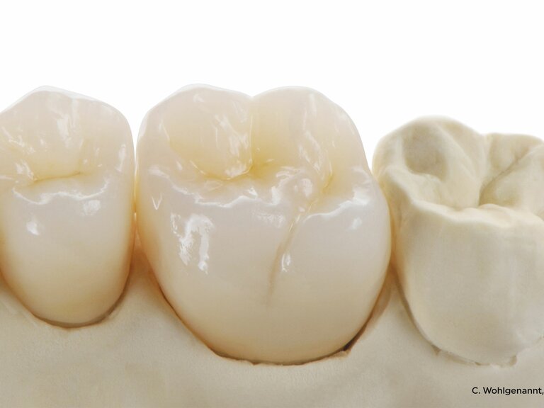 IPS e.max Prime : Ivoclar