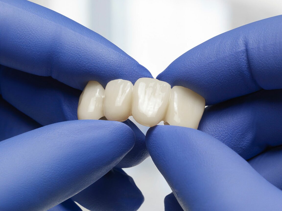 Prime Zirconia : Ivoclar