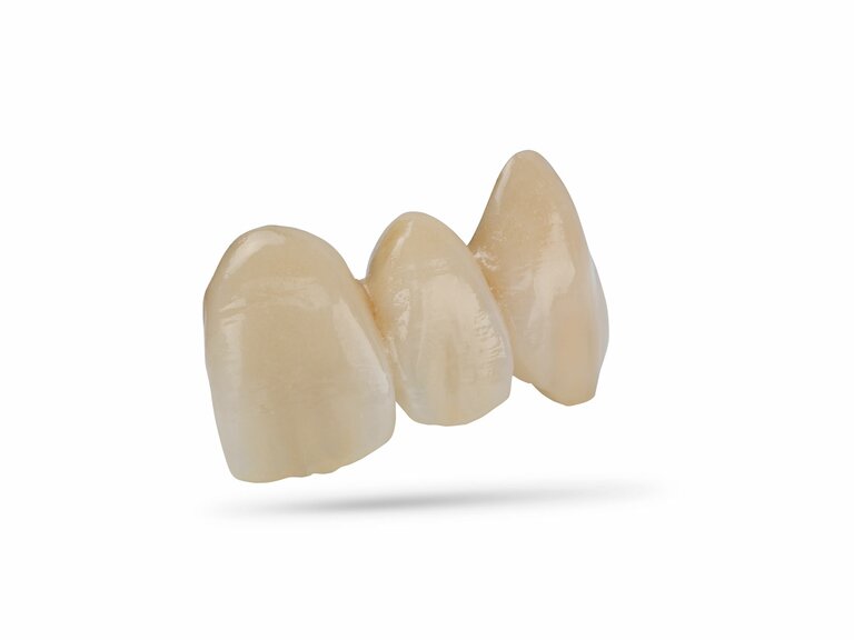 IPS Classic : Ivoclar