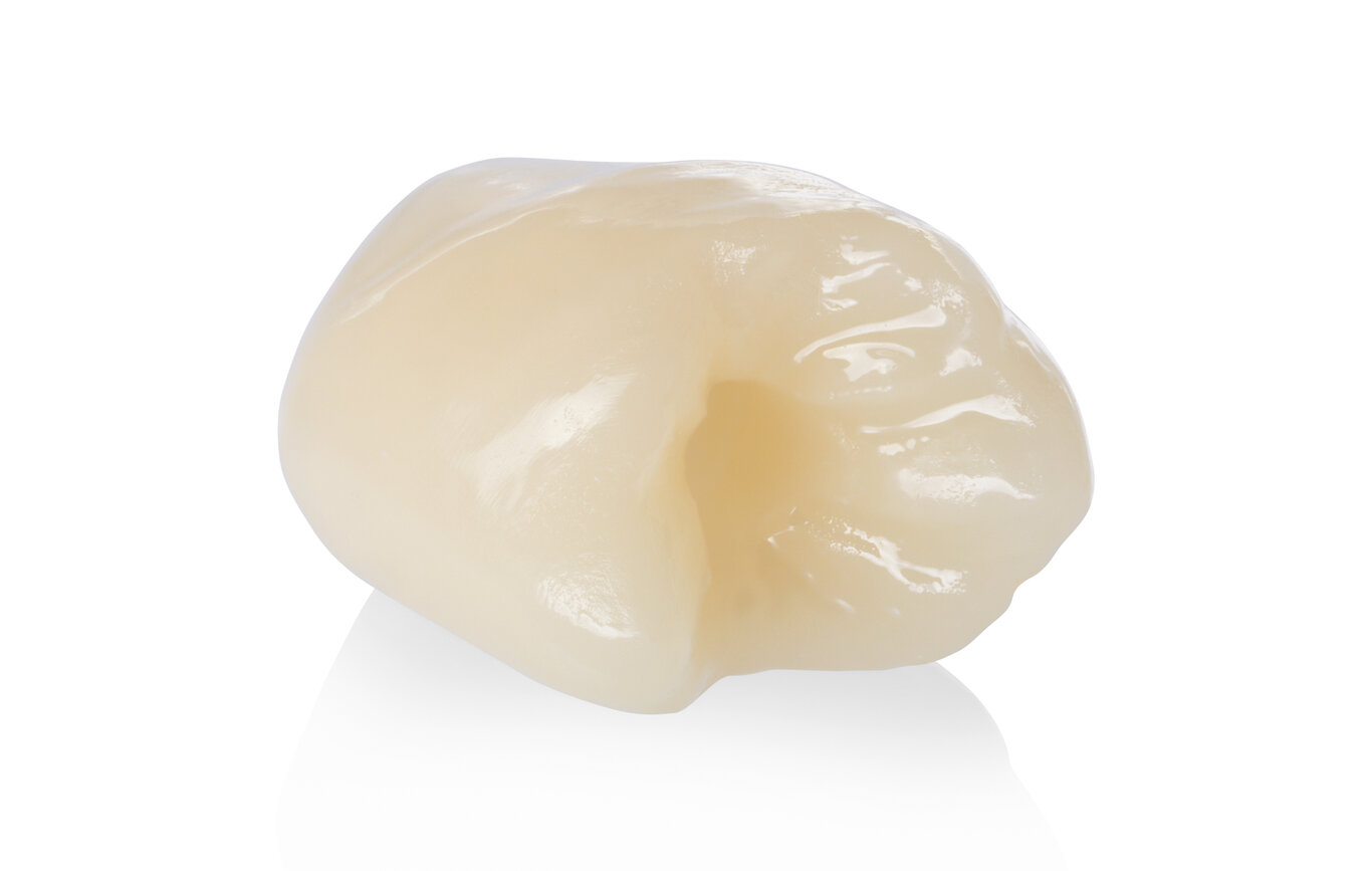 IPS e.max Press | Glass Ceramic Restorations | Ivoclar