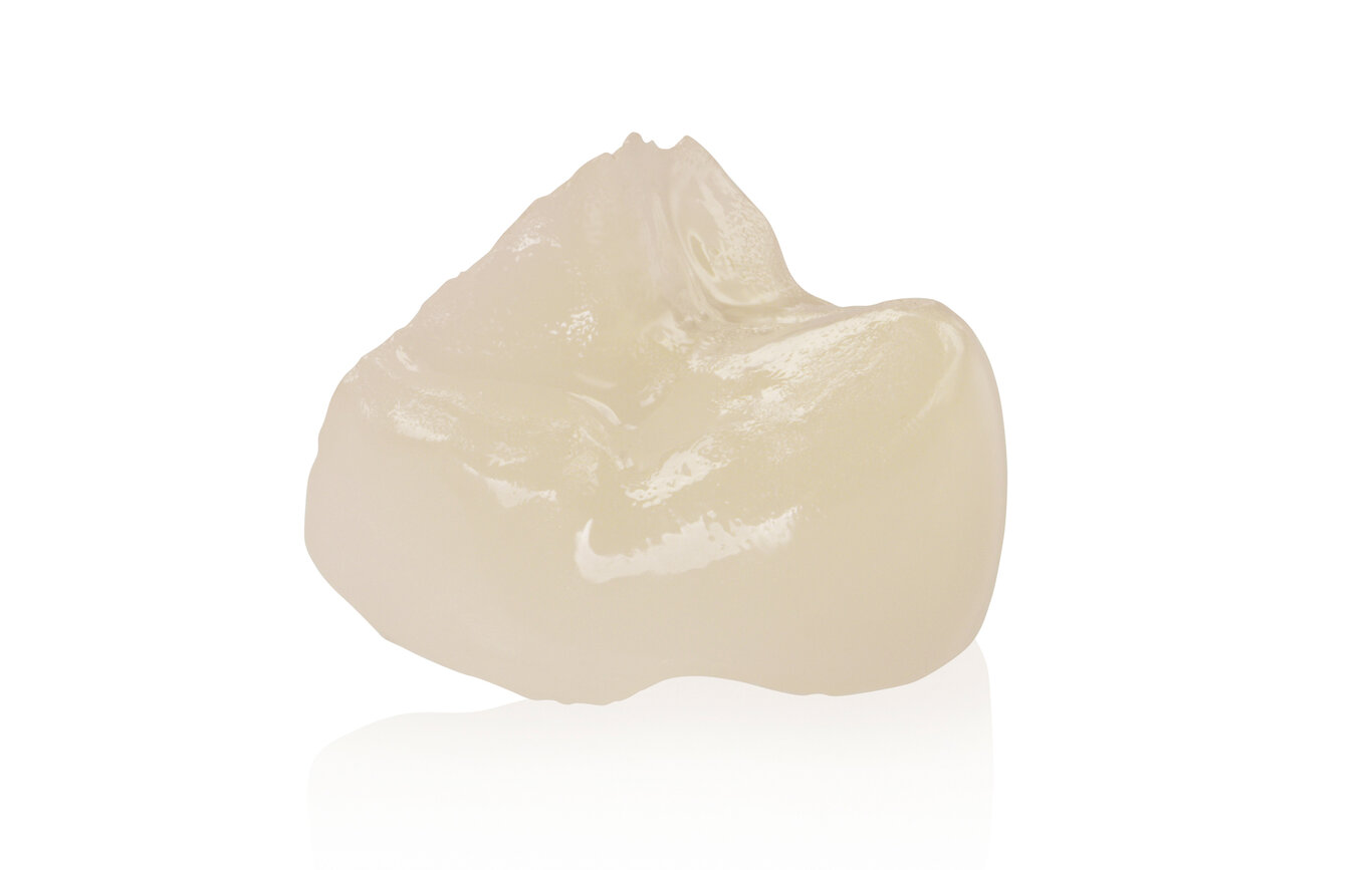 IPS e.max Press | Glass Ceramic Restorations | Ivoclar