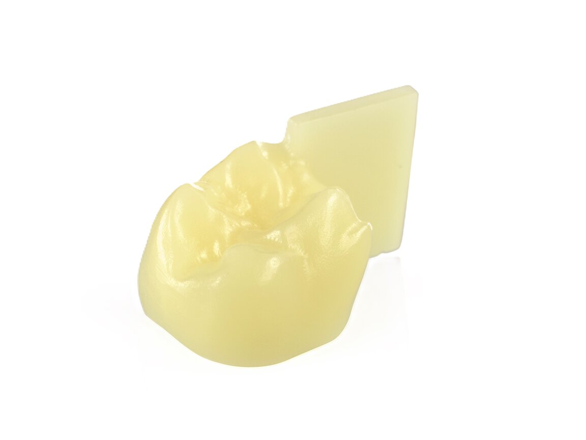 IPS e.max Press | Glass-ceramic restorations | Ivoclar LI