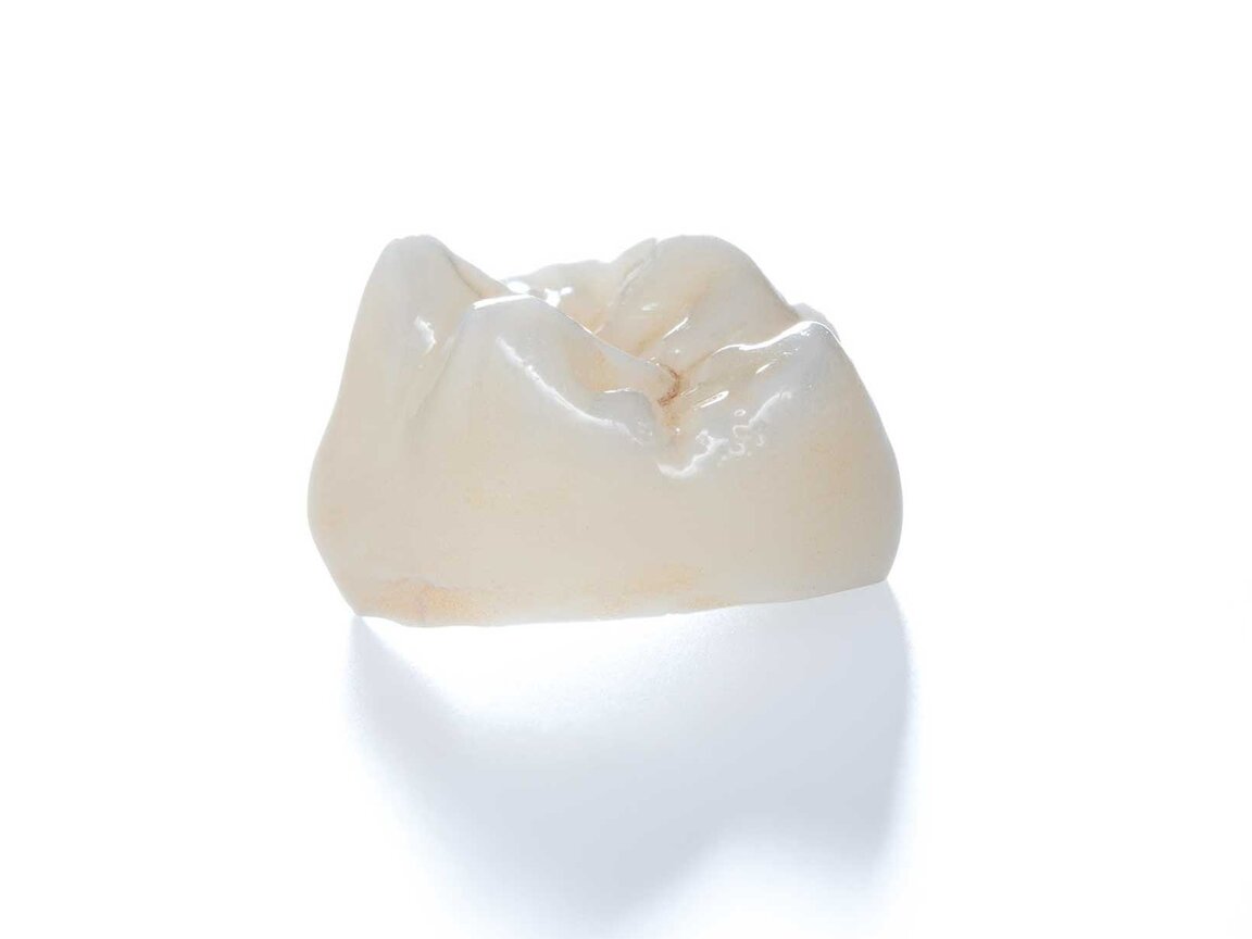 IPS e.max Press | Metal-free Dental Ceramics | Ivoclar LI