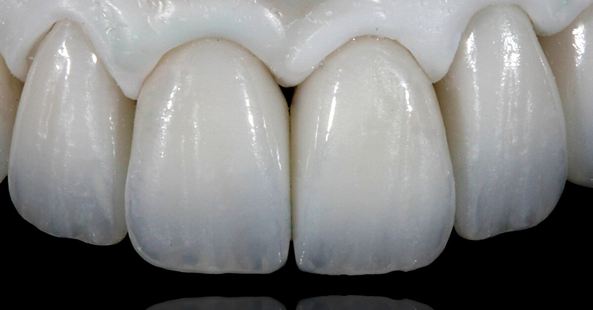 IPS Ivocolor : Ivoclar