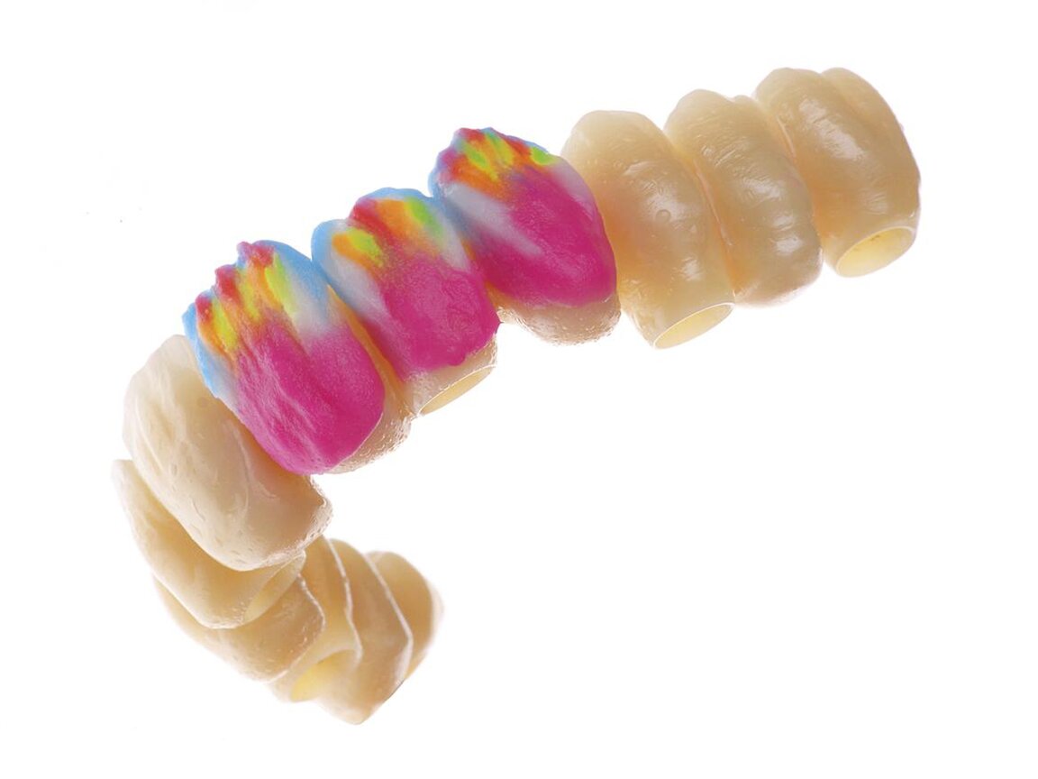 IPS e.max Ceram | Dental Veneering Material | Ivoclar