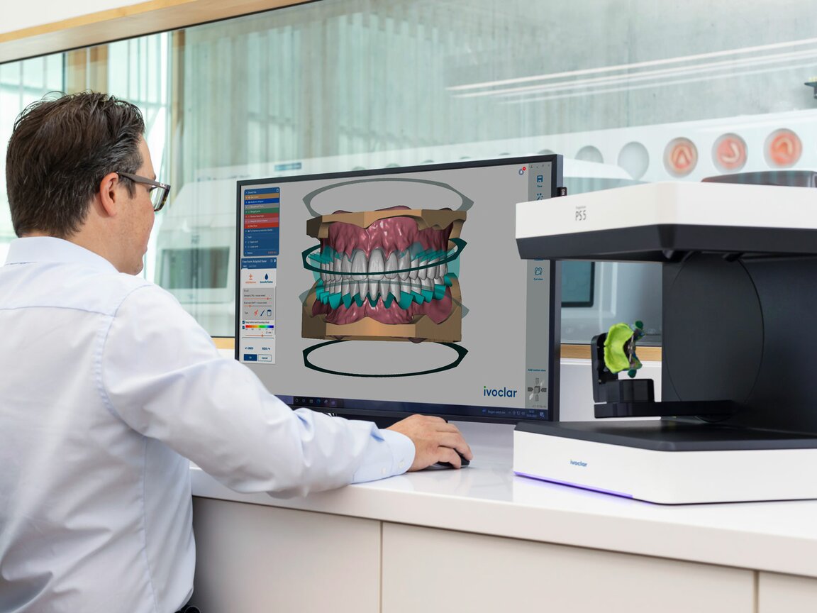 3D Dental Printing | Dental Workflows | Ivoclar USA