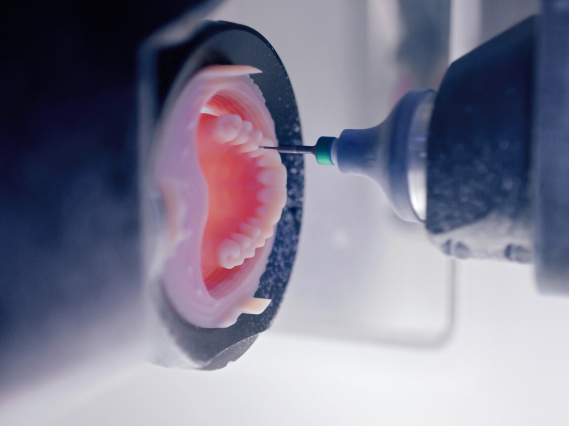 Digital Denture | Dental Workflows | Ivoclar USA