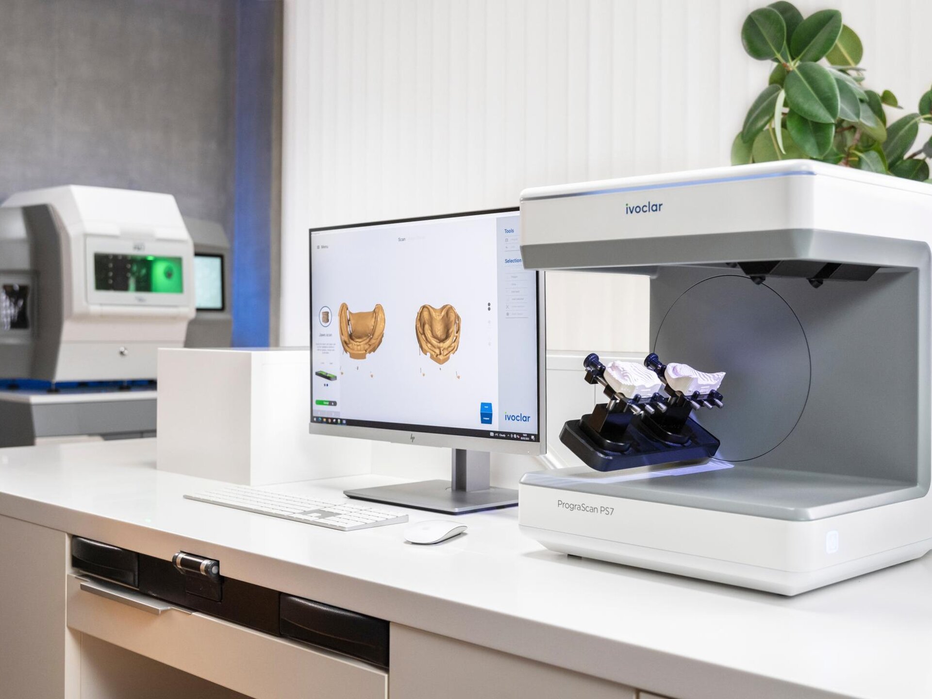 Removable Prosthetics Milling | Dental Workflows | Ivoclar