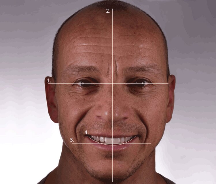 How to Get a Naturally Bright Smile | Ivoclar GB & IE