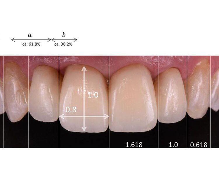 How to Get a Naturally Bright Smile | Blog | Ivoclar USA