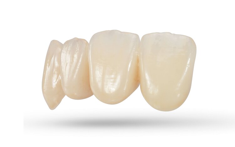 ZirCAD Cement | Dental Cementation | Ivoclar USA