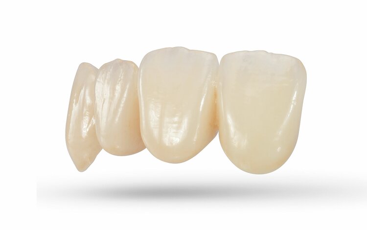ZirCAD Cement | Dental Cementation | Ivoclar