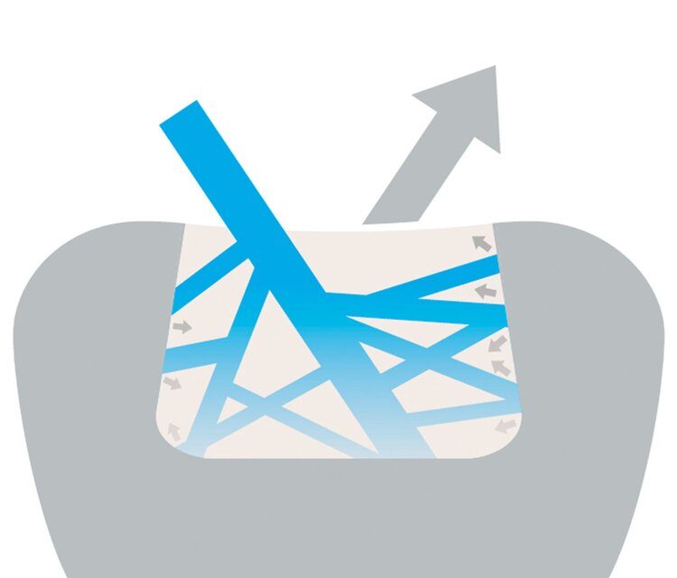 Tetric plus | Simplified universal composite | Ivoclar