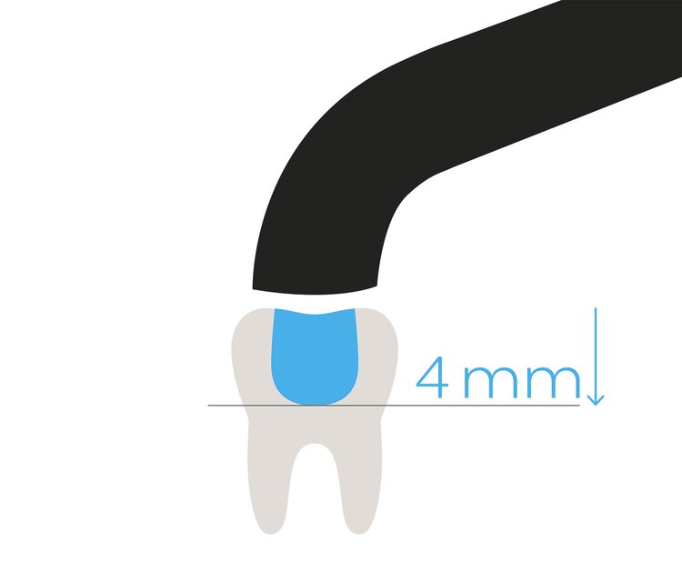 Tetric plus | Simplified universal composite | Ivoclar