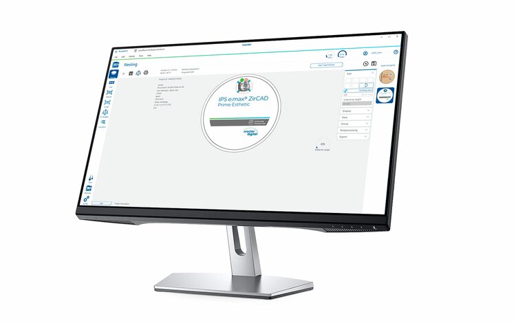 PrograMill CAM Software | Dental Milling Software | Ivoclar USA