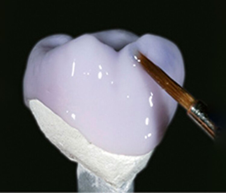 IPS e.max CAD | Lithium disilicate block for CAD/CAM | Ivoclar