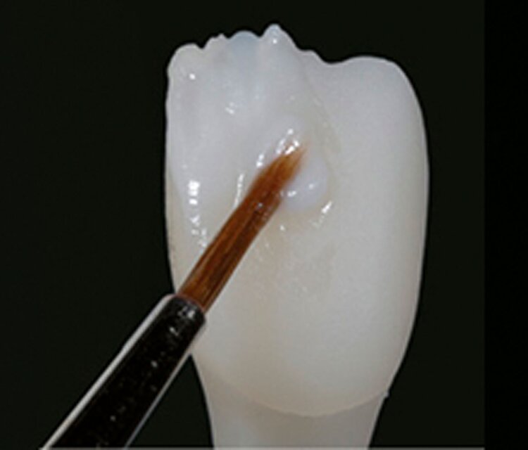 IPS e.max CAD | Lithium disilicate block for CAD/CAM | Ivoclar