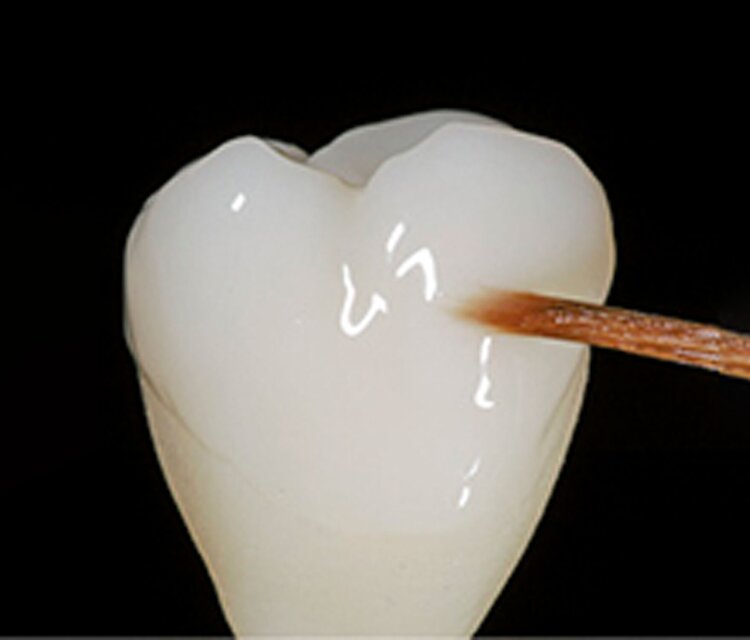 IPS e.max CAD | Lithium disilicate block for CAD/CAM | Ivoclar