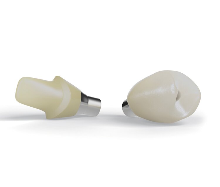 IPS e.max Press | Glaskeramik-Restaurationen | Ivoclar