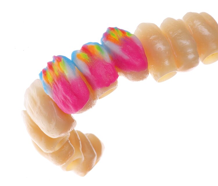 IPS e.max ZirCAD Prime | Zirconia Restorations | Ivoclar LI