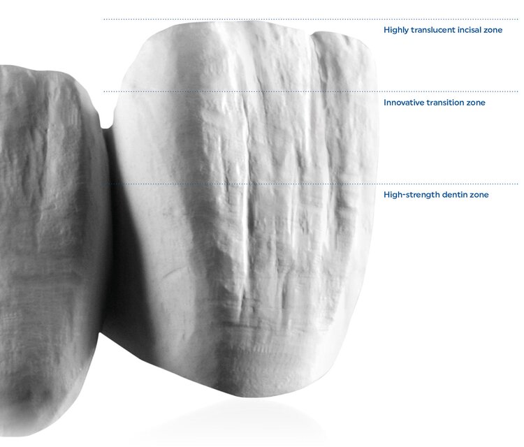 IPS e.max ZirCAD Prime | Zirconia Restorations | Ivoclar LI
