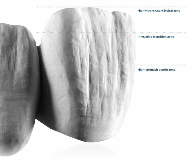 IPS e.max ZirCAD Prime | Zirconia Restorations | Ivoclar USA