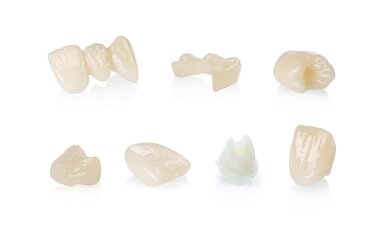 IPS e.max Press | Glass Ceramic Restorations | Ivoclar