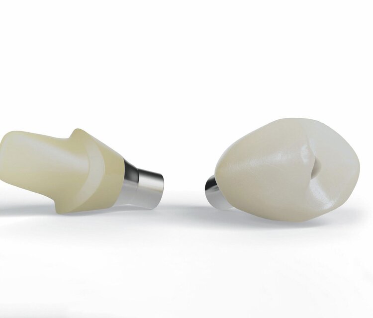 IPS e.max Press | Glass-ceramic restorations | Ivoclar LI