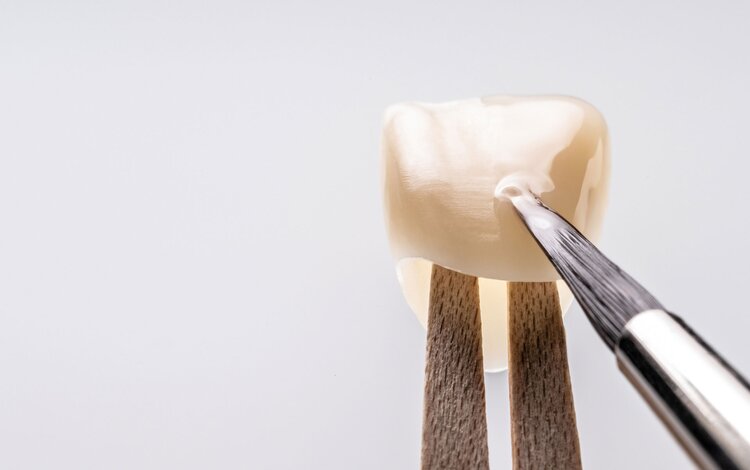 IPS e.max Ceram Art | Ceramic stain and glaze pastes | Ivoclar NZ