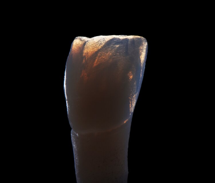 IPS e.max Ceram | Dental Veneering Material | Ivoclar