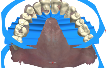 Regaining Confidence Through Digital Dentistry | Ivoclar NZ