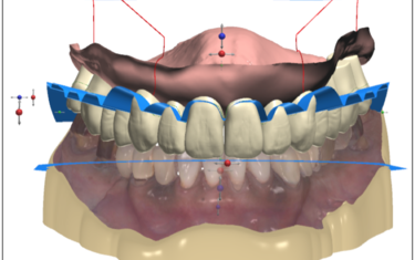 Regaining Confidence Through Digital Dentistry | Ivoclar AU