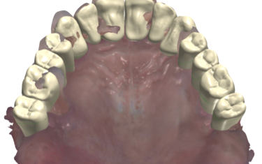 Regaining Confidence Through Digital Dentistry | Ivoclar AU