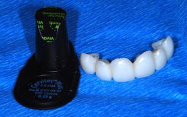 Cervitec Plus: Professional Care | Blog | Ivoclar USA