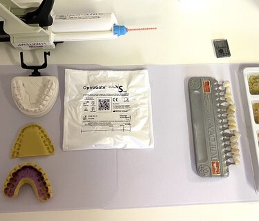 Less is More: Custom Designing a Smile with Minimally Invasive Veneers ...