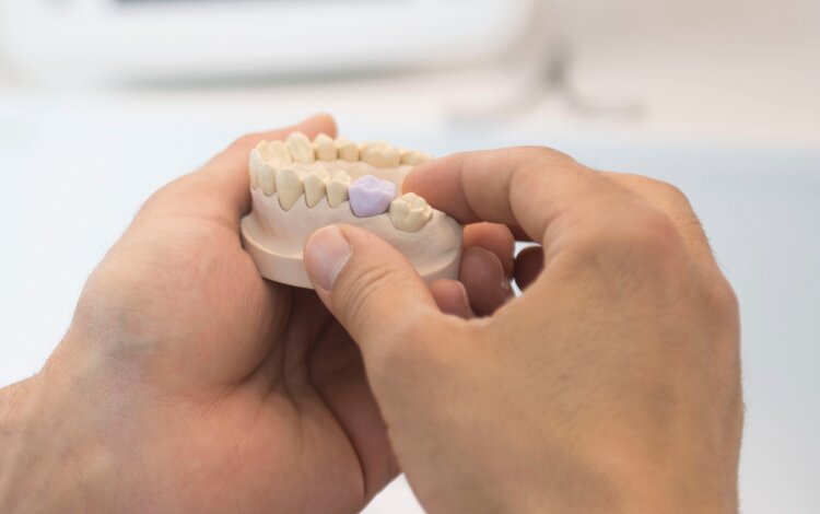 All-Ceramics | Make it emax | Ivoclar