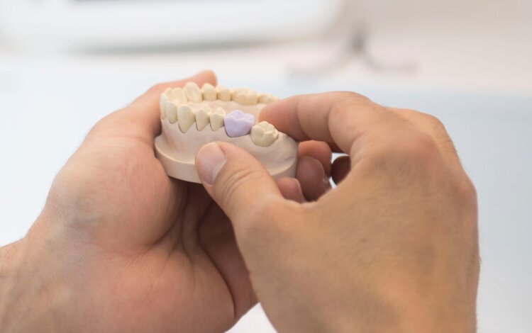 Make it emax : Ivoclar